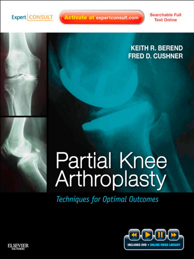 Partial Knee Arthroplasty.pdf | PDF | Orthopedic Surgery | Knee