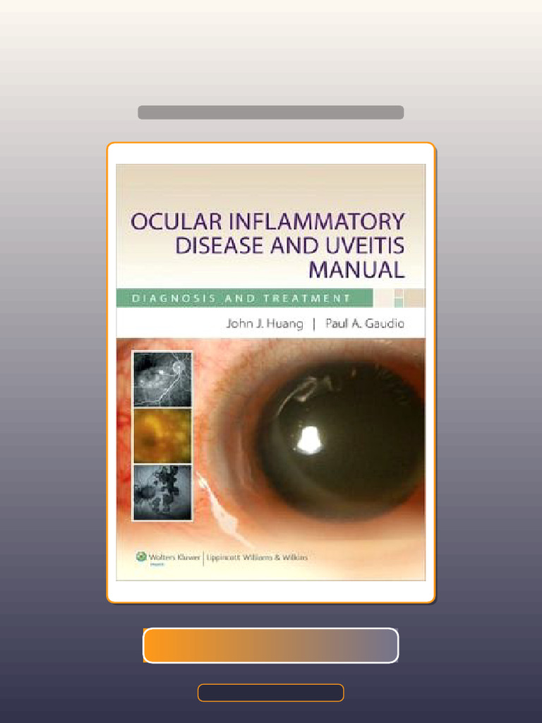 Test Bank for Ocular Inflammatory Disease and Uveitis Manual Diagnosis ...
