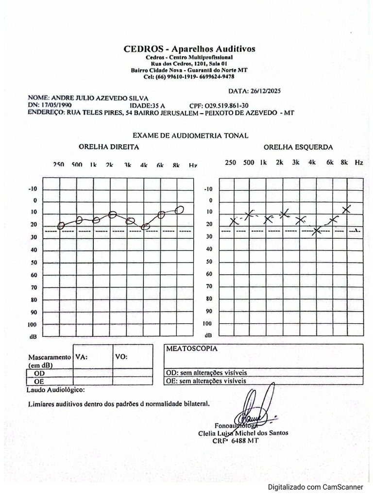 10. Audiometria Tonal Com | PDF