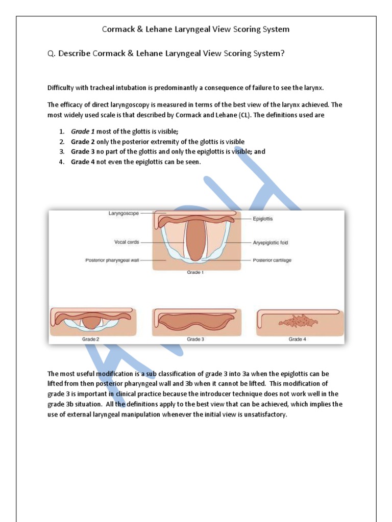 Cormack & Lehane | PDF