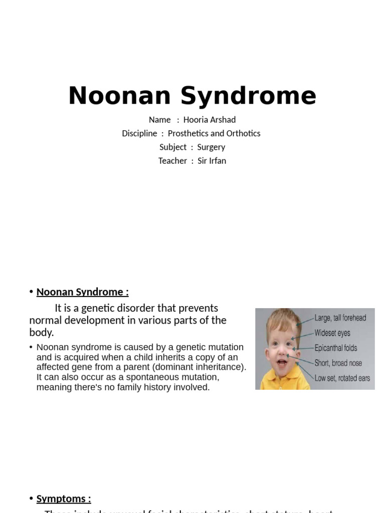 Noonan Syndrome | PDF