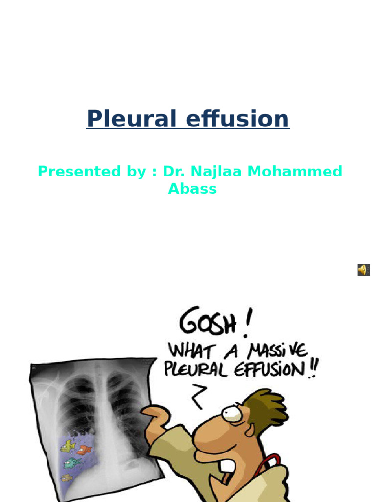 Understanding Pleural Effusion Causes & Diagnosis | PDF | Lung | Thorax ...