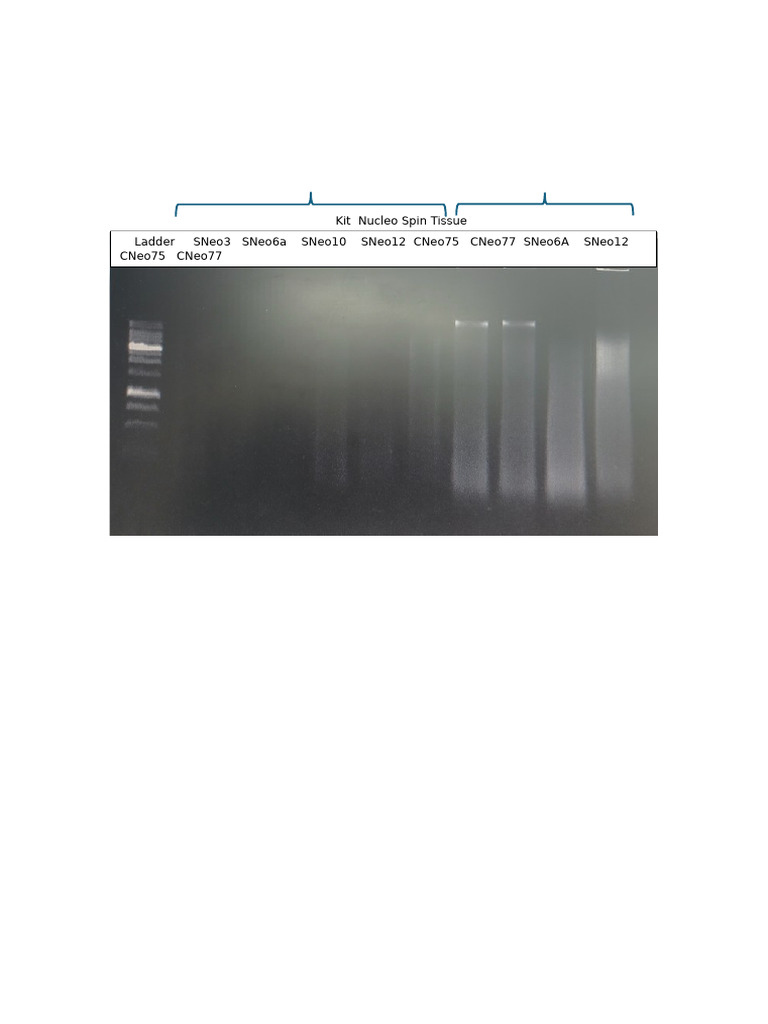 Extracción ADN NucleoSpin Tissue | PDF