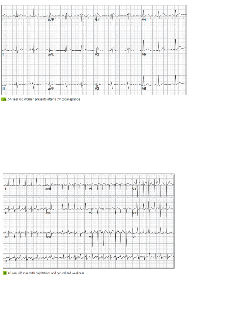 ECGS | PDF