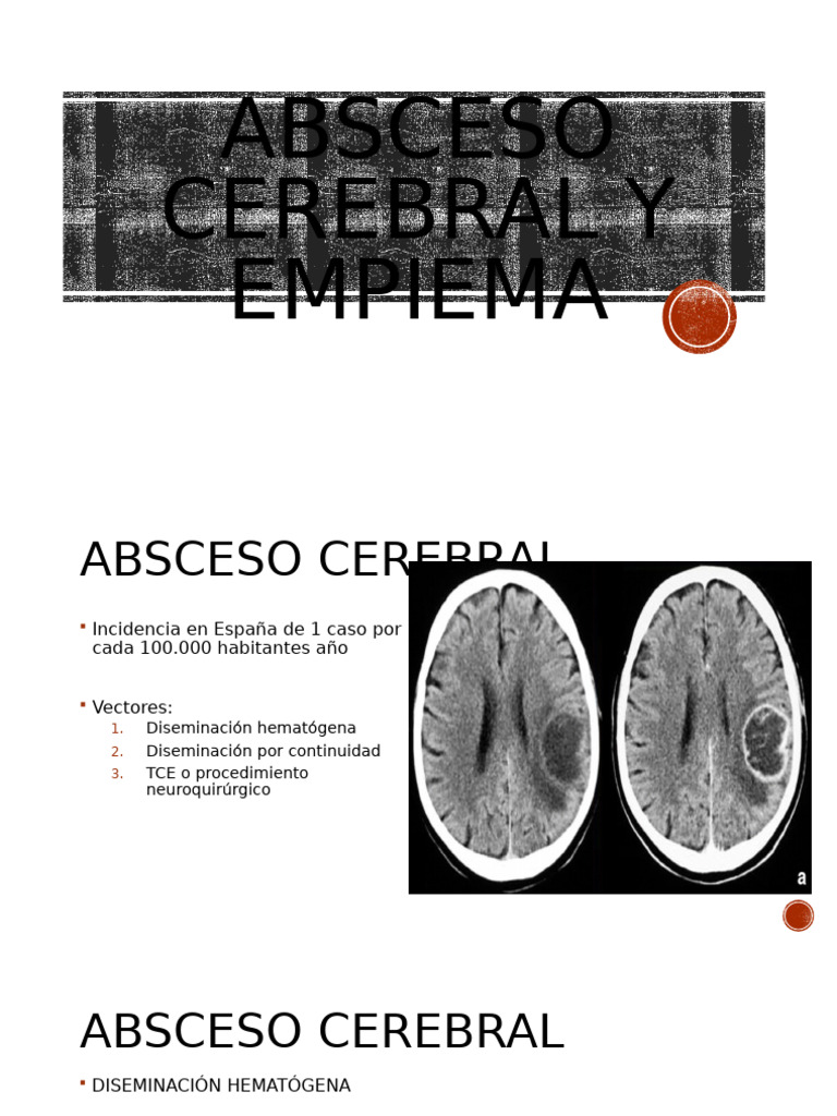 Absceso Cerebral y Empiema [Autosaved] | PDF | Microbiología | Medicina ...