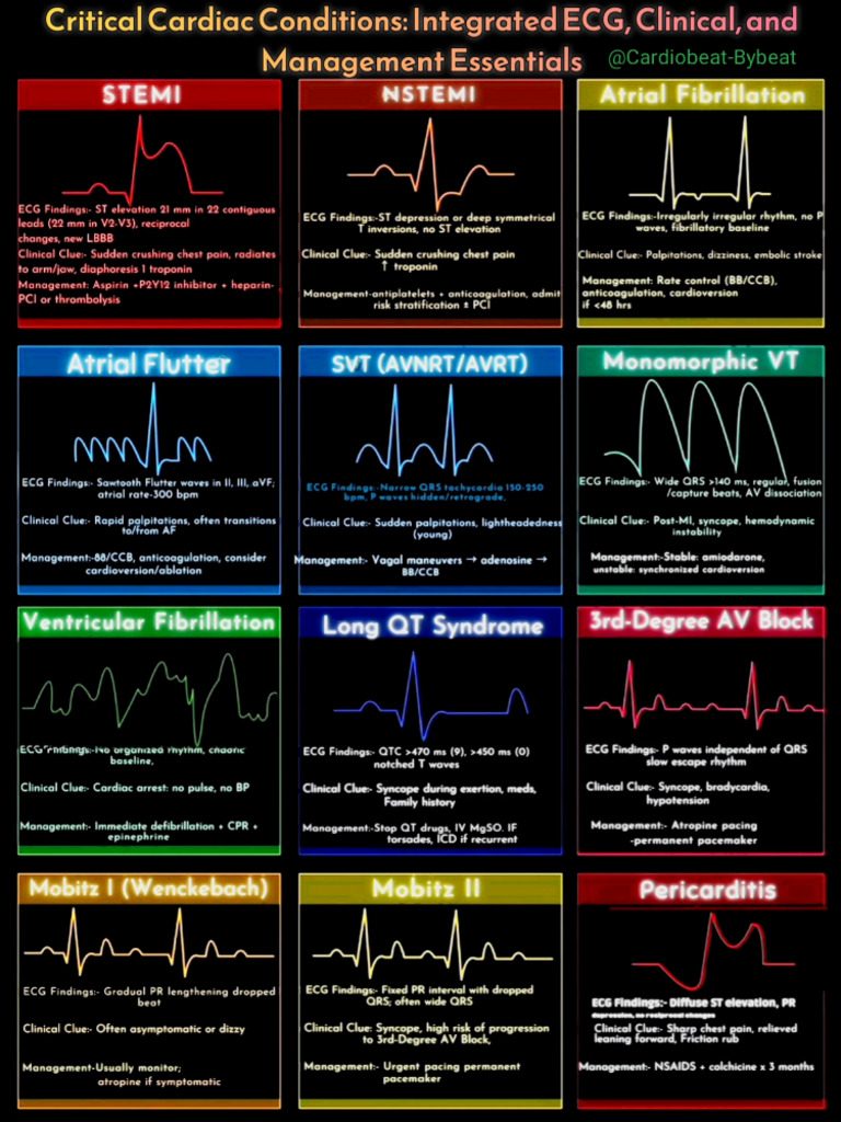 ECG Cheat Sheet | PDF