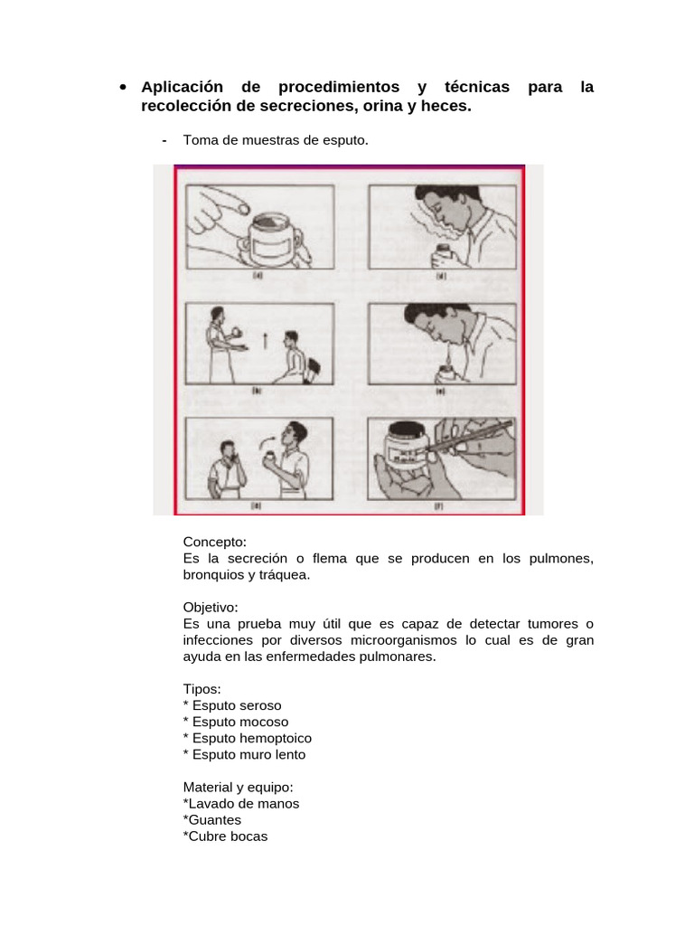 Recolección y Análisis de Esputo | PDF