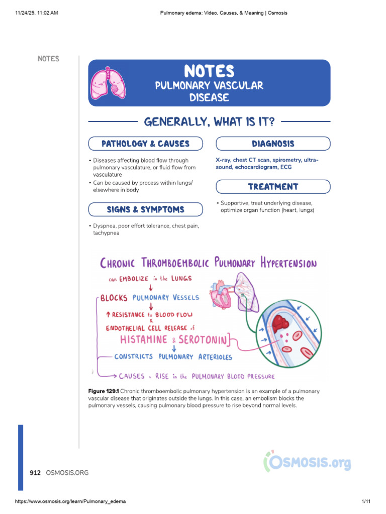Pulmonary Edema: Causes & Video Guide | PDF