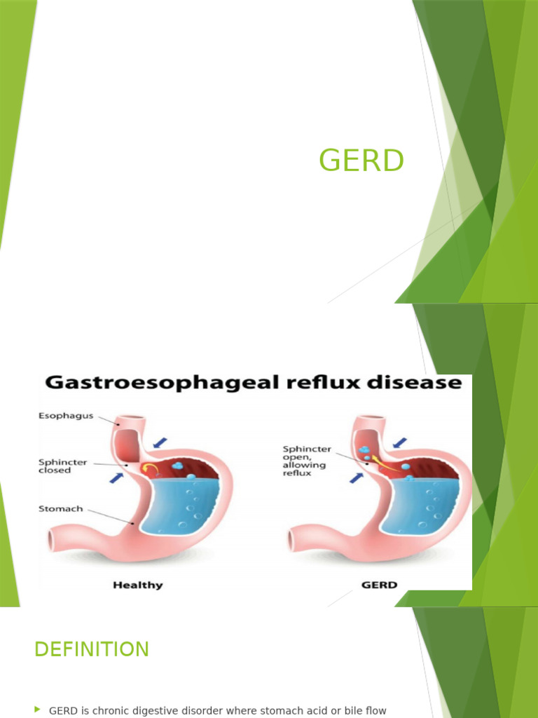 GERD | PDF