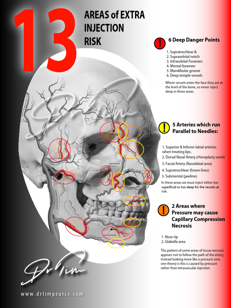 13 Injection Areas With Extra Risk 3 2 | PDF