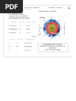 Barrett Toric IOL Calculator v2.0 | PDF