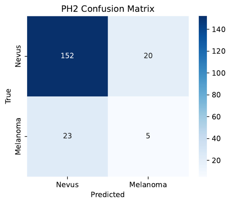 Ph2 Advanced Confusion Matrix | PDF
