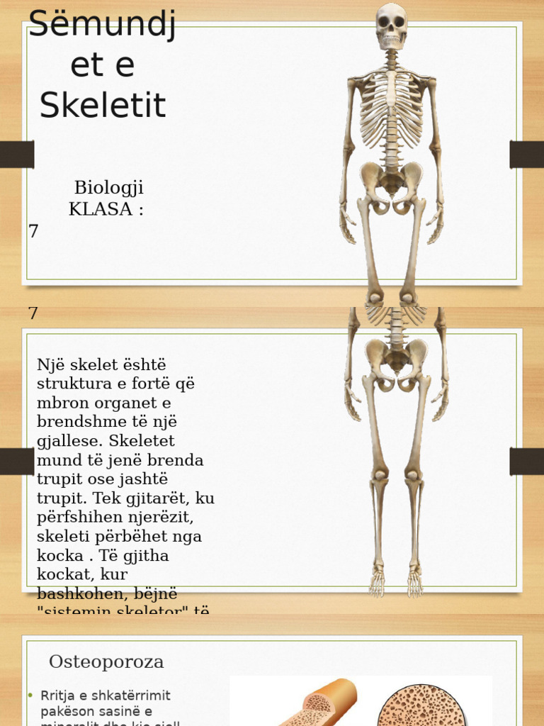 Sëmundjet e Skeletit | PDF