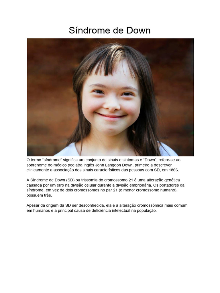 Trabalho de Síndrome de Down | PDF