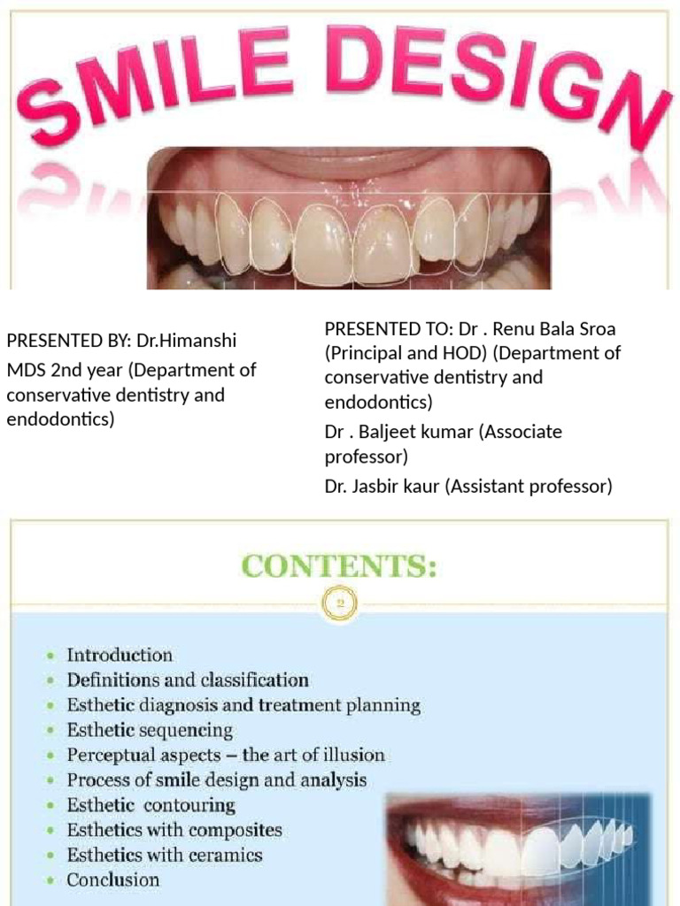 Seminar Smile Design | PDF