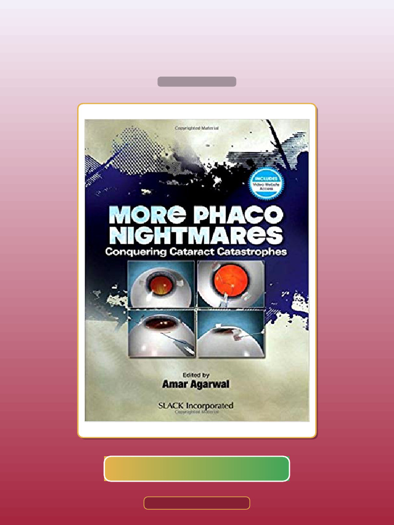 Test Bank for More Phacoo Nightmares by Amar Agarwal MS FRCS FRCOphth ...