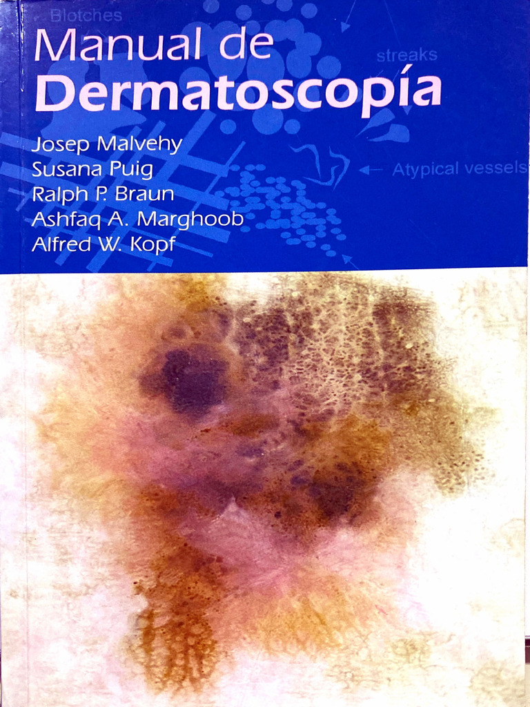 Dermatoscopía 98 pág pdf | PDF
