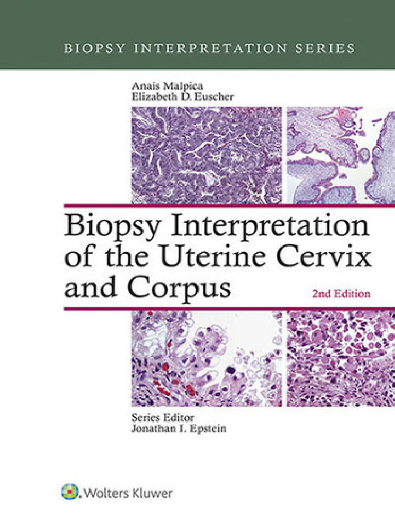 Biopsy Interpretation of the Uterine Cervix and Corpus | PDF