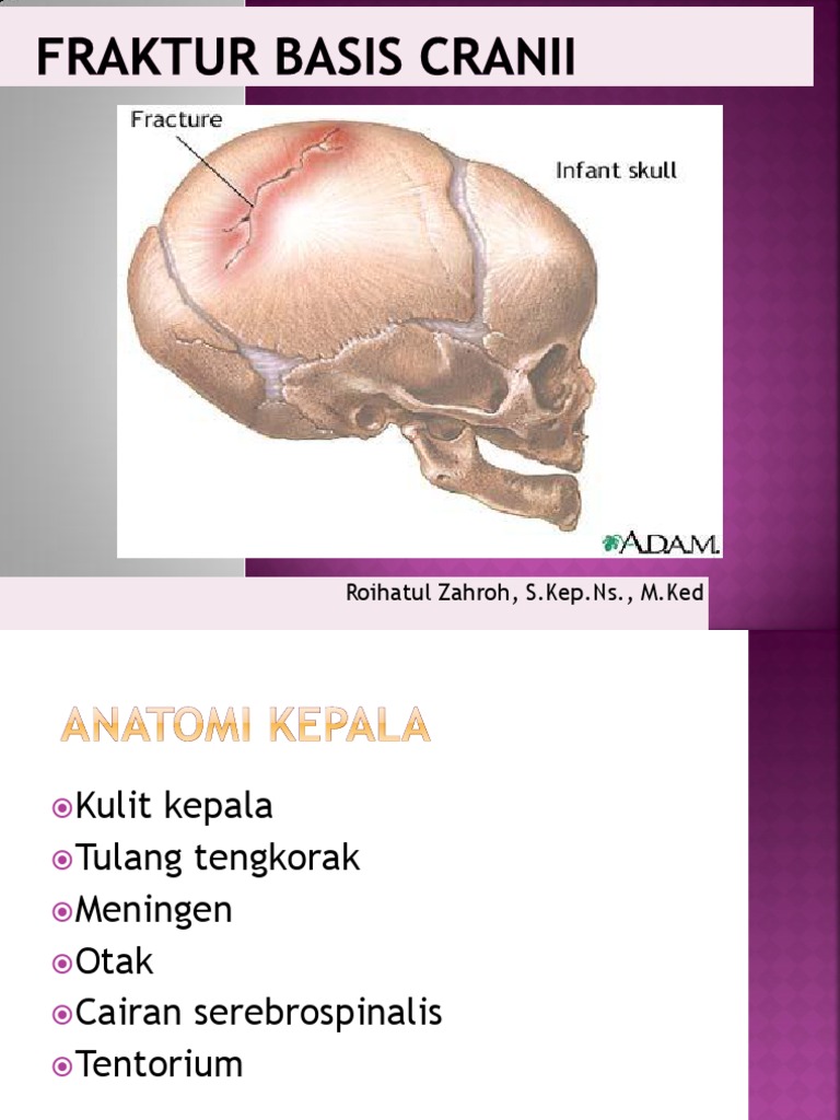 Fraktur Basis Cranii | PDF