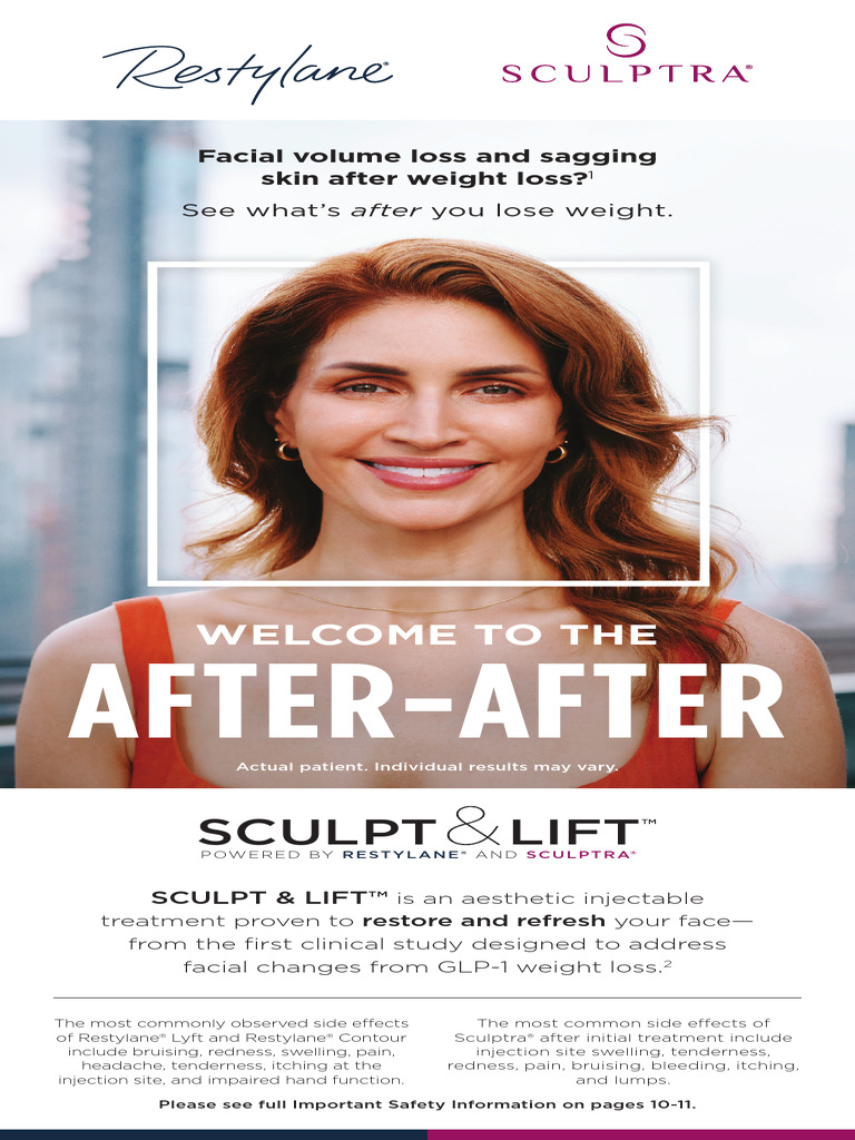 Sculptra & Restylane Side Effects Guide | PDF | Injection (Medicine ...