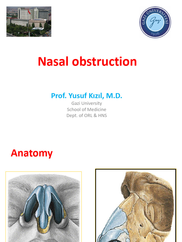 Nasal Obstruction | PDF | Human Nose | Otorhinolaryngology
