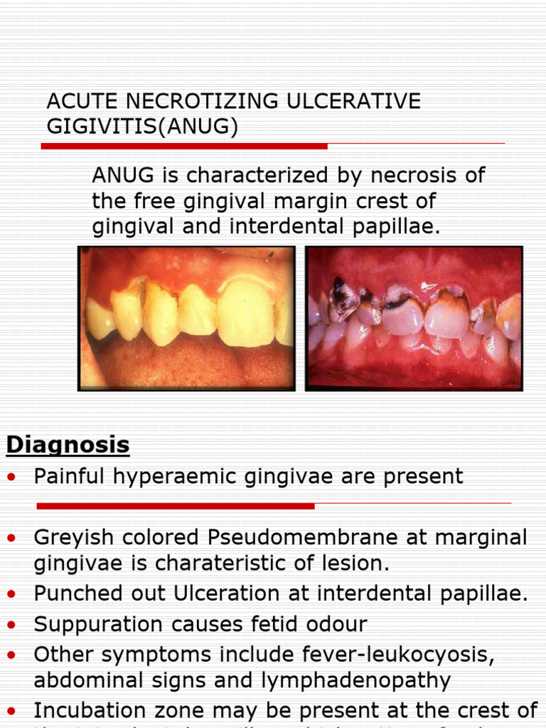 ANUG | PDF | Medical Specialties | Diseases And Disorders