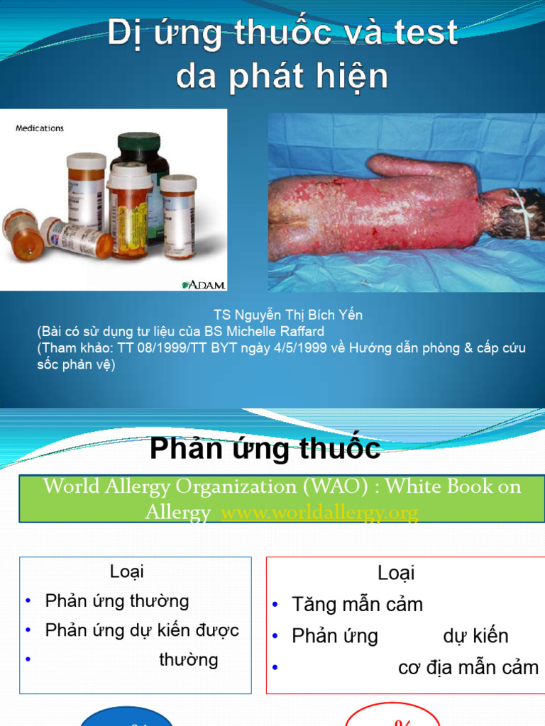 Quy Trinh Prick Test DUT | PDF