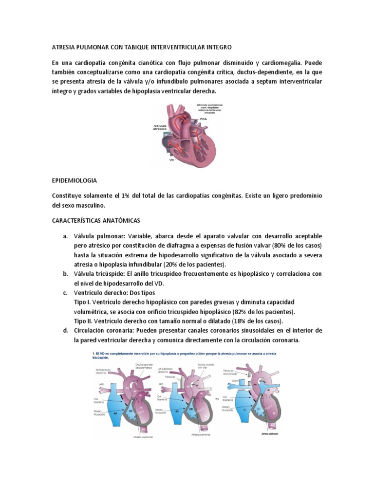 Atresia Pulmonar Con Tabique Interventricular Integro | Pulmón ...