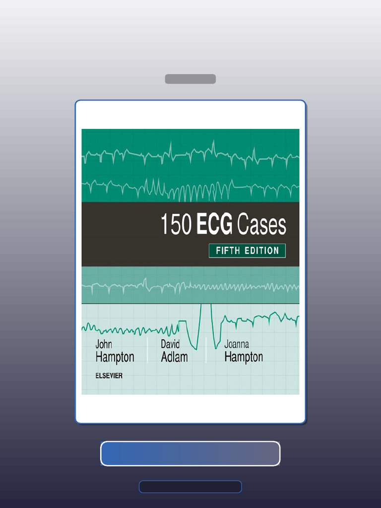 Test Bank for 150 ECG Cases Fifth Edition John Hampton | PDF | Multiple ...