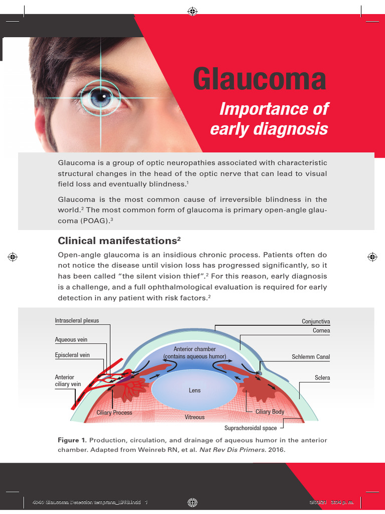 Early Diagnosis of Glaucoma Risks | PDF | Glaucoma | Ophthalmology