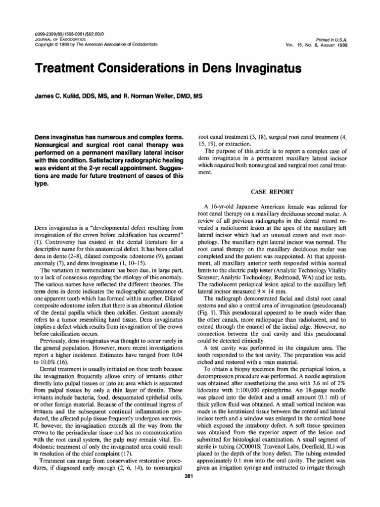 Dens Invaginatus Treatment Insights | PDF | Dental Anatomy | Dentistry ...