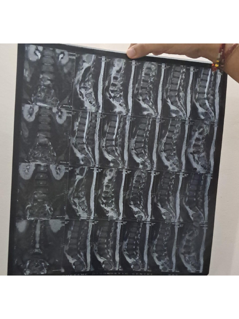 Mri Sheets | PDF