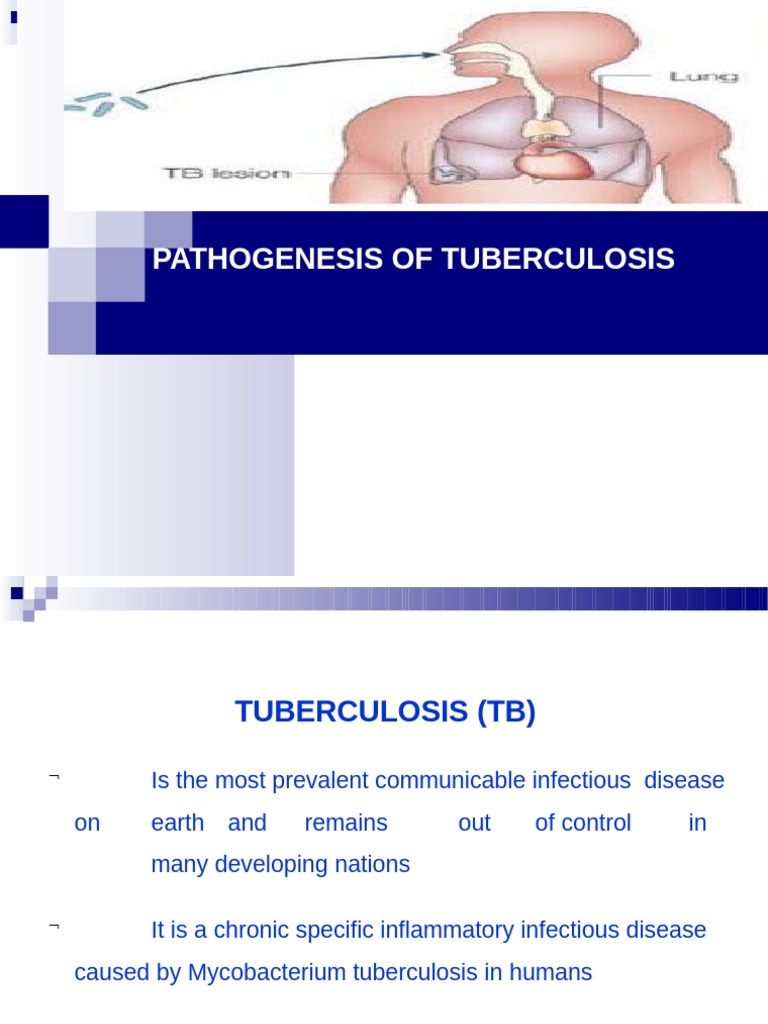 Understanding Tuberculosis Pathogenesis | PDF | Tuberculosis | Macrophage