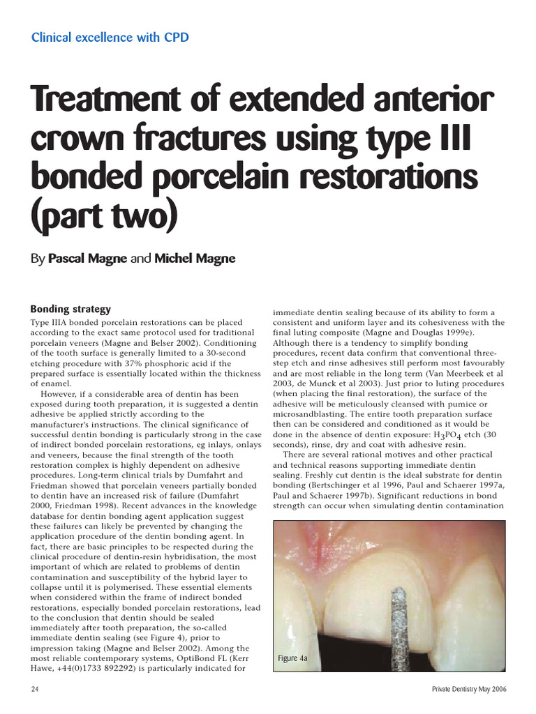 2006_Treatment of Extended2 | PDF | Ceramics | Dental Composite