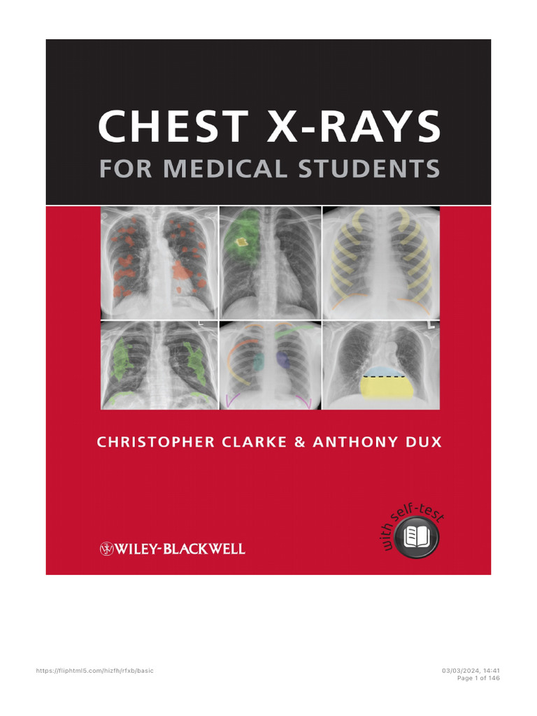 716671162 Chest X Rays for Medical Students PDFDrive Pages 1 50 Flip ...