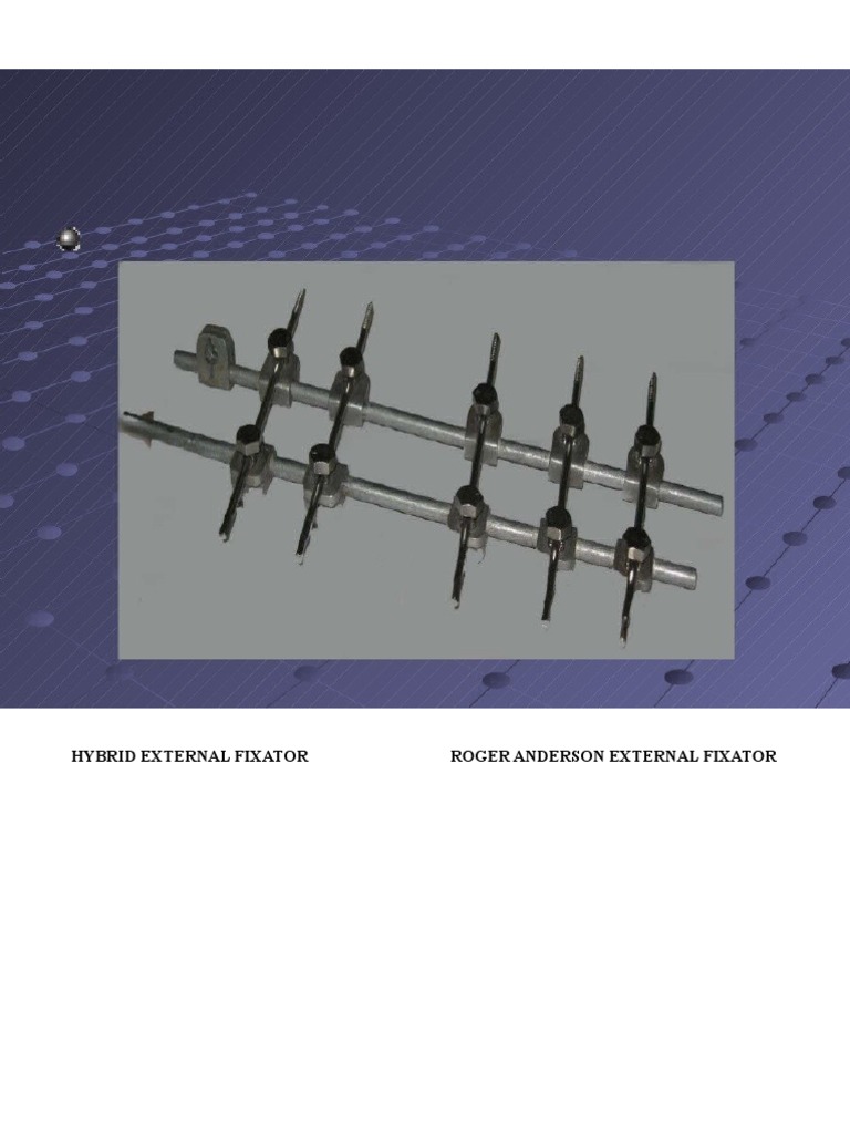 Hybrid External Fixator Roger Anderson External Fixator | PDF ...