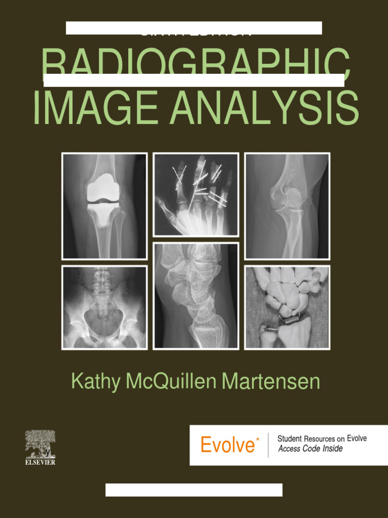 Radiographic Image Analysis Guide | PDF | Human Leg | Elbow