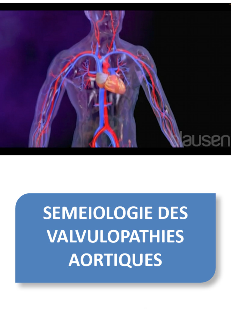 Séméiologie des Valvulopathies Aortiques | PDF | Thorax | Système ...