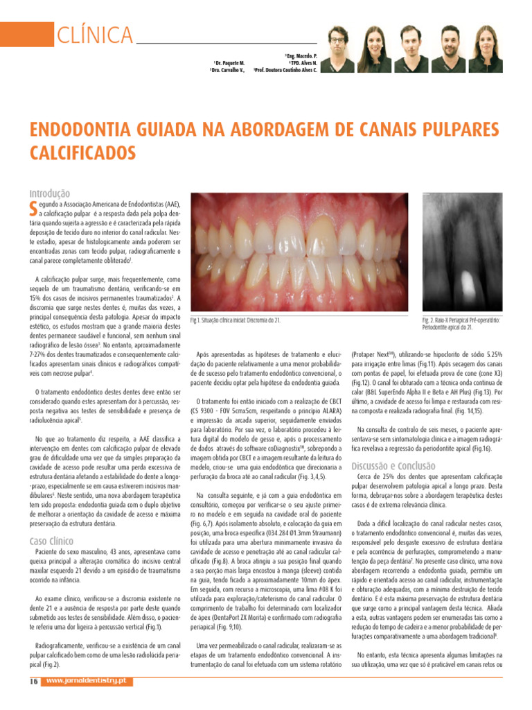 Estou compartilhando o arquivo 'Endodontia-Guiada' com você | PDF ...