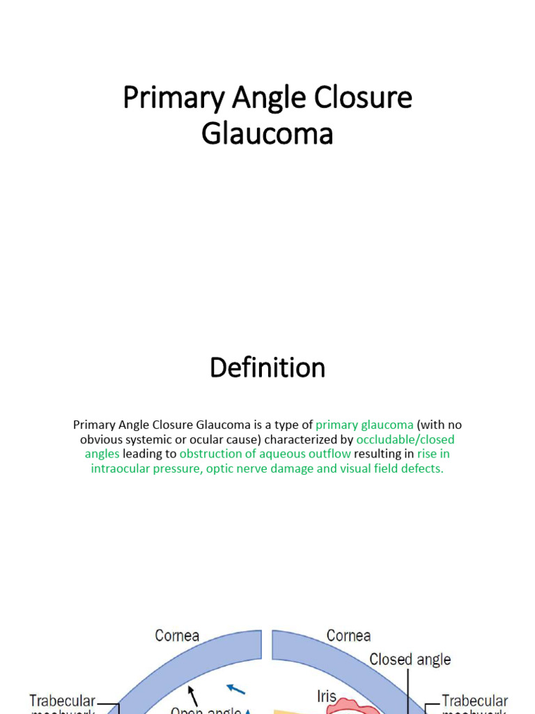 Primary Angle Closure Glaucoma | PDF | Glaucoma | Diseases And Disorders