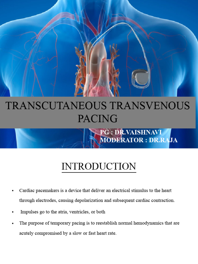 Transcutaneous Transvenous Pacing Guide | PDF | Heart | Cardiovascular ...