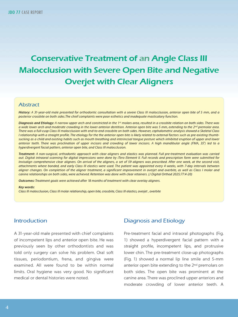 Class III Malocclusion Treatment with Aligners | PDF | Dental Anatomy ...