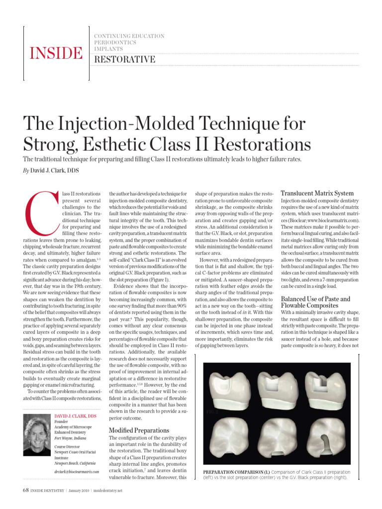 Clark Class II Injec Mold Inside Dent Injection | PDF | Mouth | Dentistry