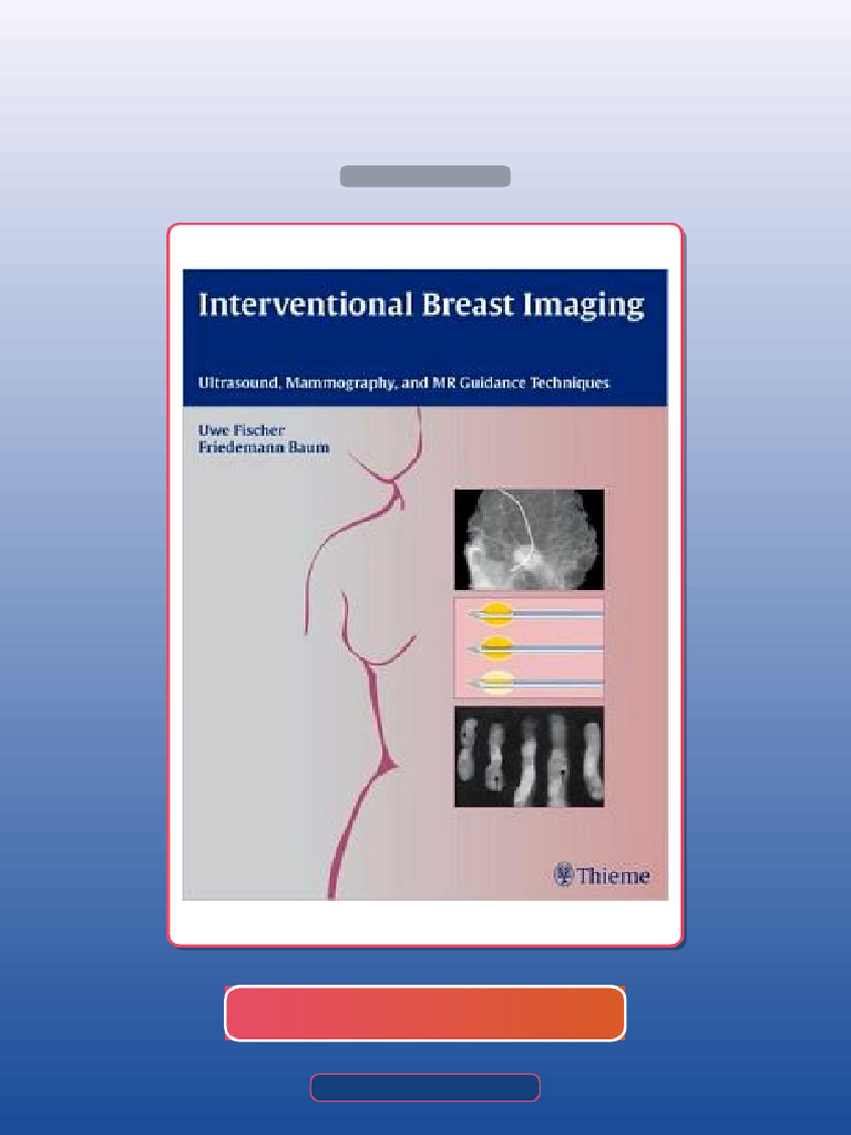 Interventional Breast Imaging Ultrasound Mammography and MR Guidance ...
