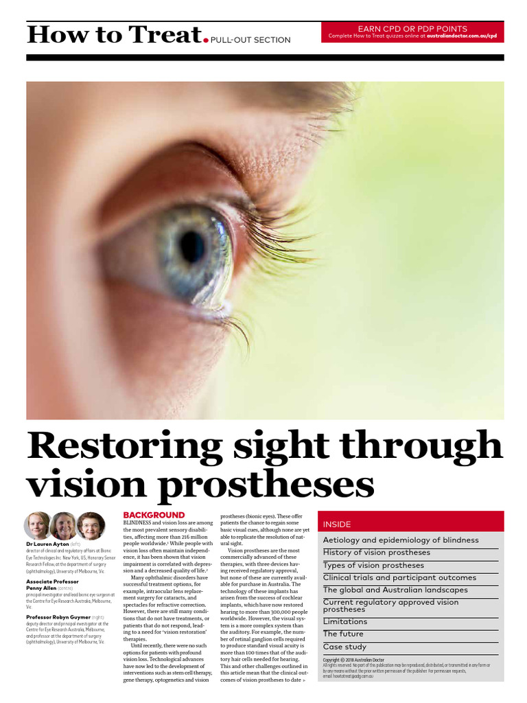 Vision Prostheses: Restoring Sight Options | PDF | Visual Impairment ...