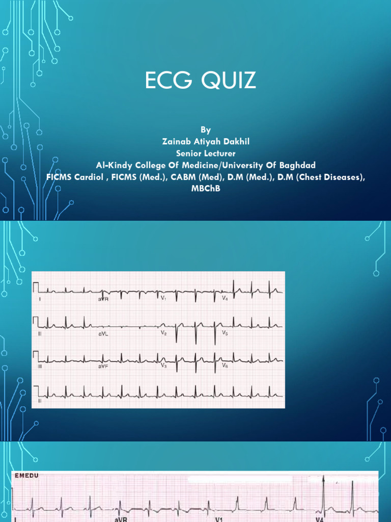 ECG Quiz on Differential Diagnosis | PDF