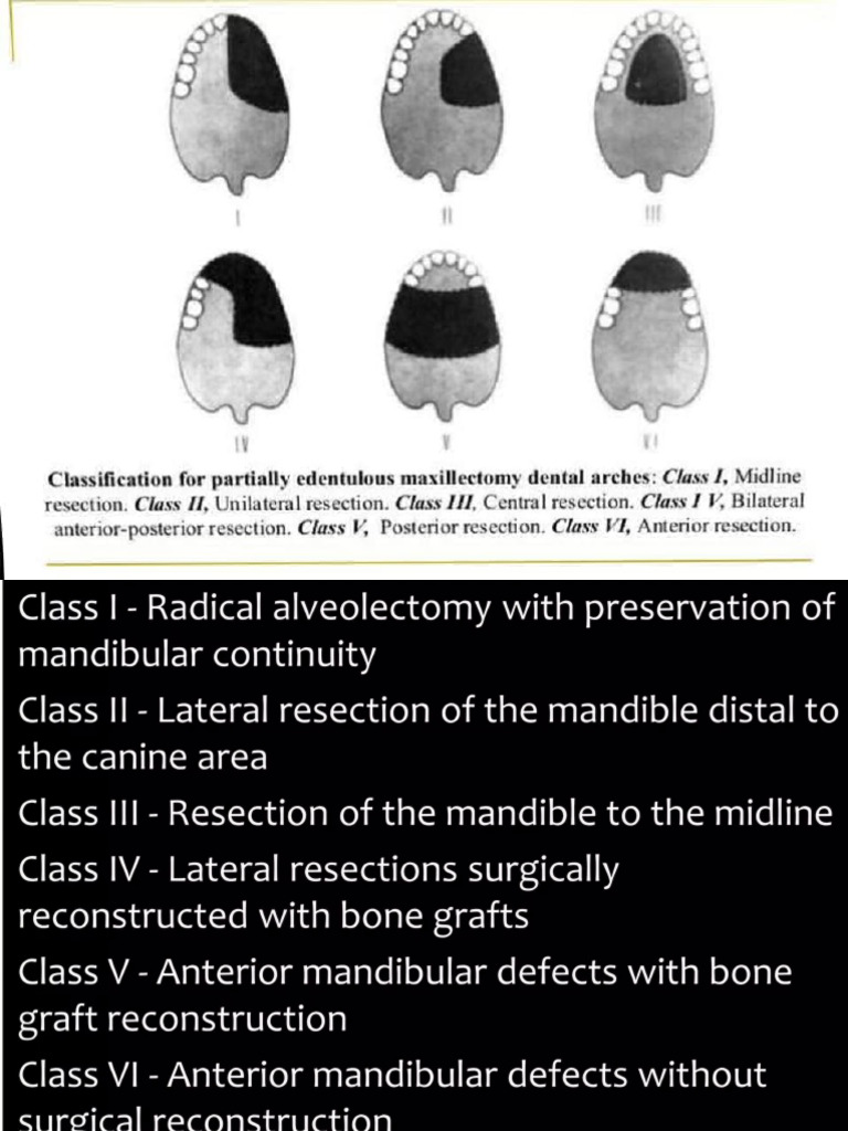 Oral Surgery Classification | PDF