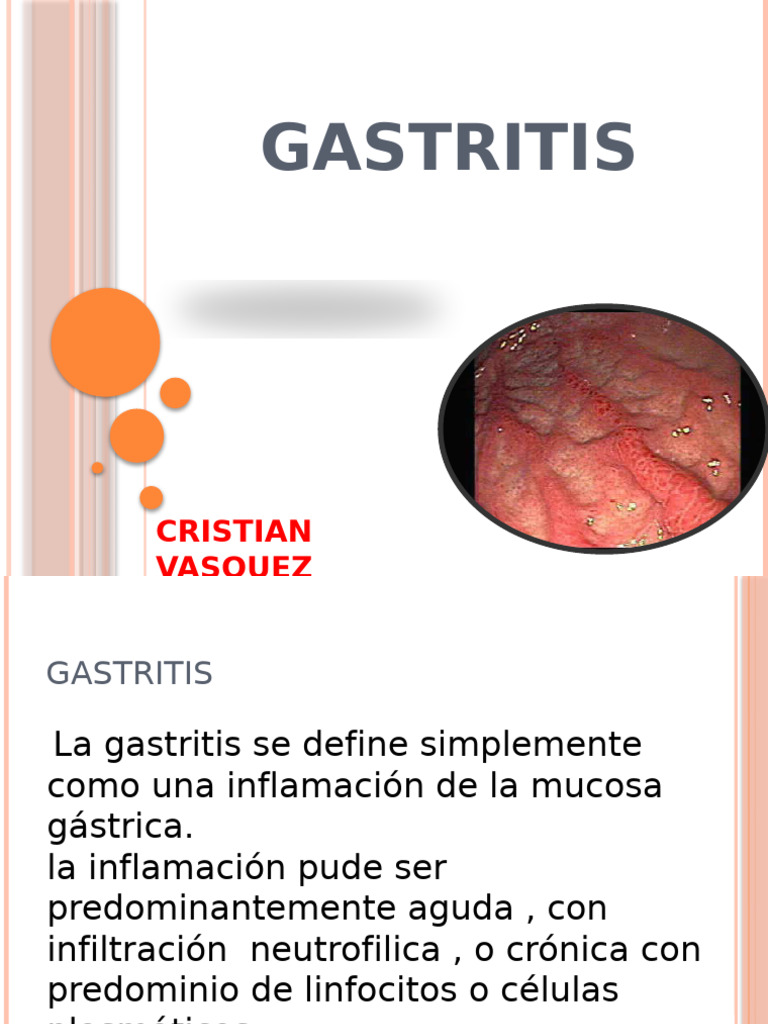gastritis aguda y crónica | PDF | Estómago | Inflamación