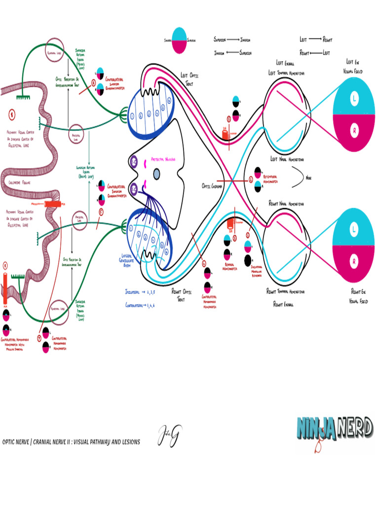 Optic Nerve Cranial Nerve II- Visual Pathway and Lesions (1) Atf | PDF