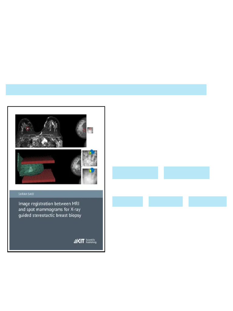 Image registration between MRI and spot mammograms for X-ray guided ...
